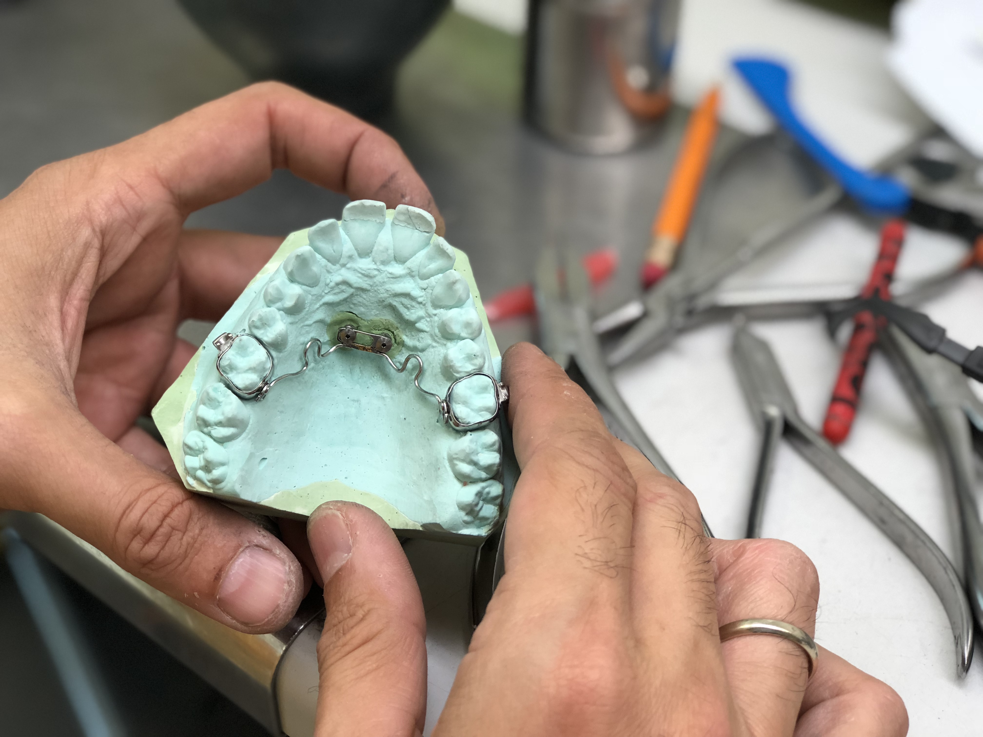 Orthodontic Lab - Uniontech
